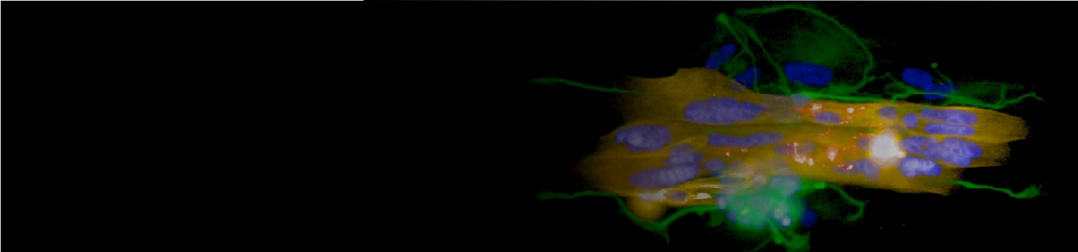 CYTOO: Muscle Pathology CRO & Drug Discovery Services