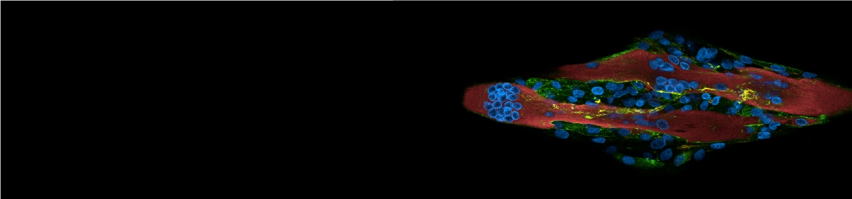 Advanced Muscle Disease Modeling for Drug Development | CYTOO